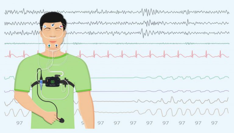 Getting Ready for a Sleep Test? Here’s What to Expect : Florida Dental ...